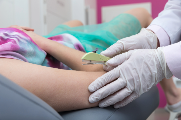 PhilHealth Covers IUD, Implant, BTL, and Vasectomy for Free in Public ...
